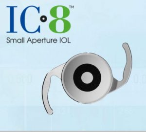 IOL Expert IC-8 | IOLS Directory