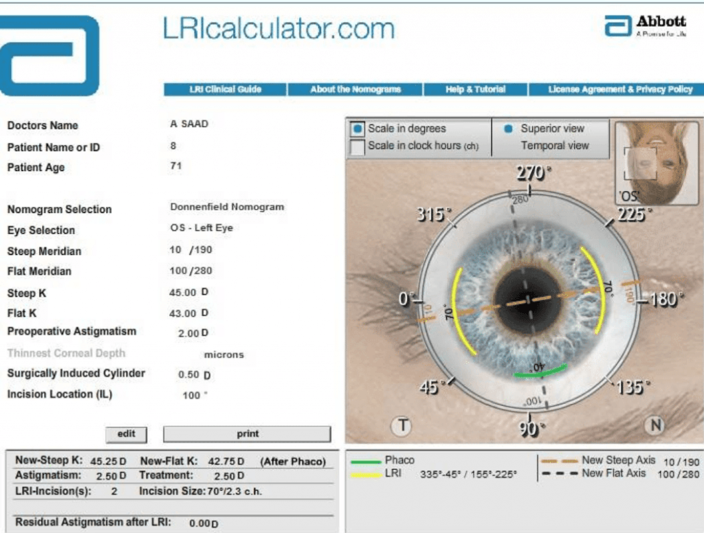 Limbal Relaxing Incision Online Nomogram | IOLS Directory